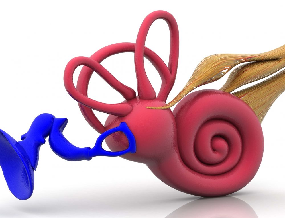 Vestibular Disorder Treatment: Bilateral Vestibular Loss