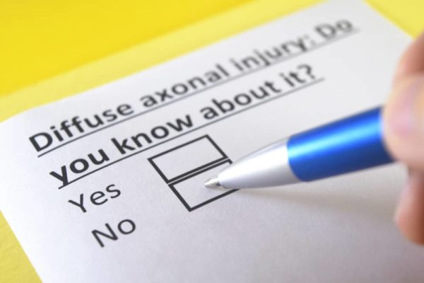 Diffuse Axonal Brain Injury: Causes, Symptoms, Treatment