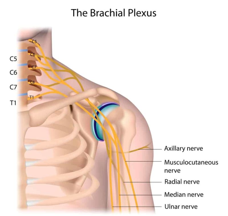 Brachial Plexus Injury Treatment - Propel Physiotherapy