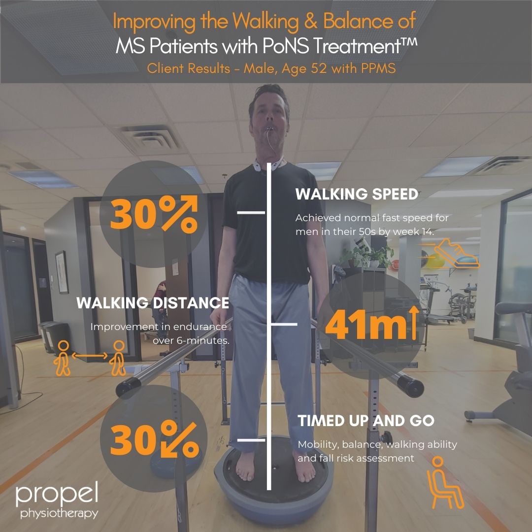 PoNS Therapy for MS: Case Study Effects on Walking & Balance