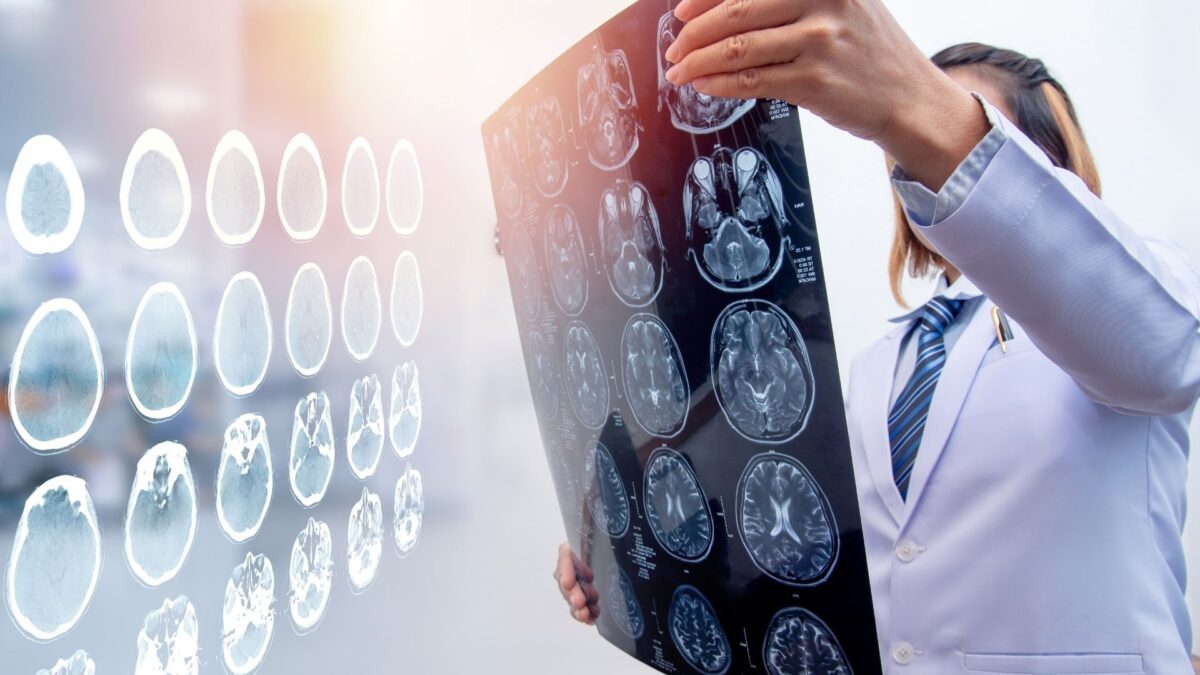 Effects of Brain Injury: How Location Impacts Outcome