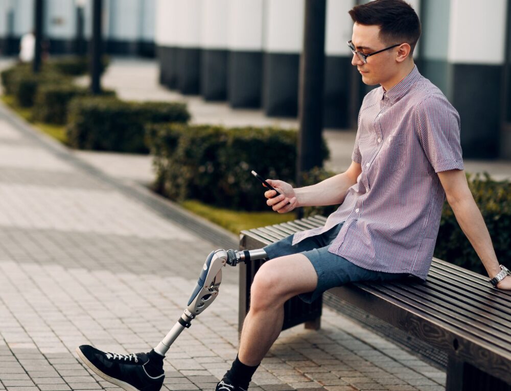 Leg Amputation Rehabilitation - Propel Physiotherapy