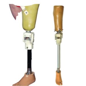 Prosthetic Leg Fit: Types of Knee Prosthesis for Leg Amputations