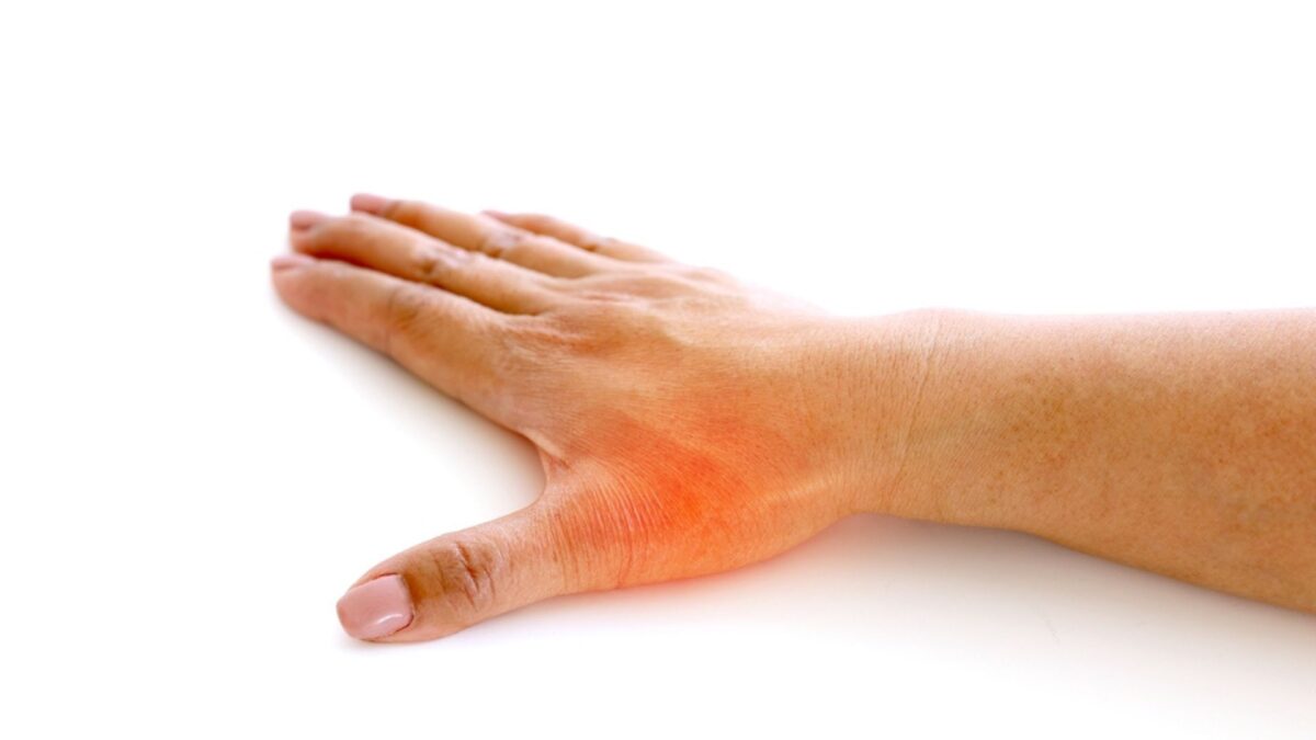 Non-Surgical Thumb Osteoarthritis Treatment
