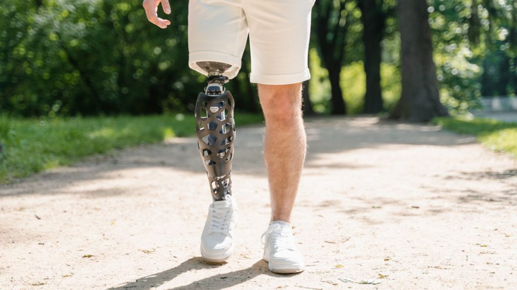 Amputation Archives - Propel Physiotherapy